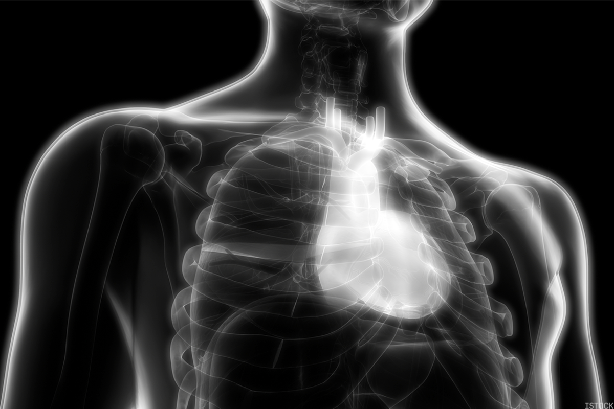 AtriCure Made an Important Upside Breakout - TheStreet Pro